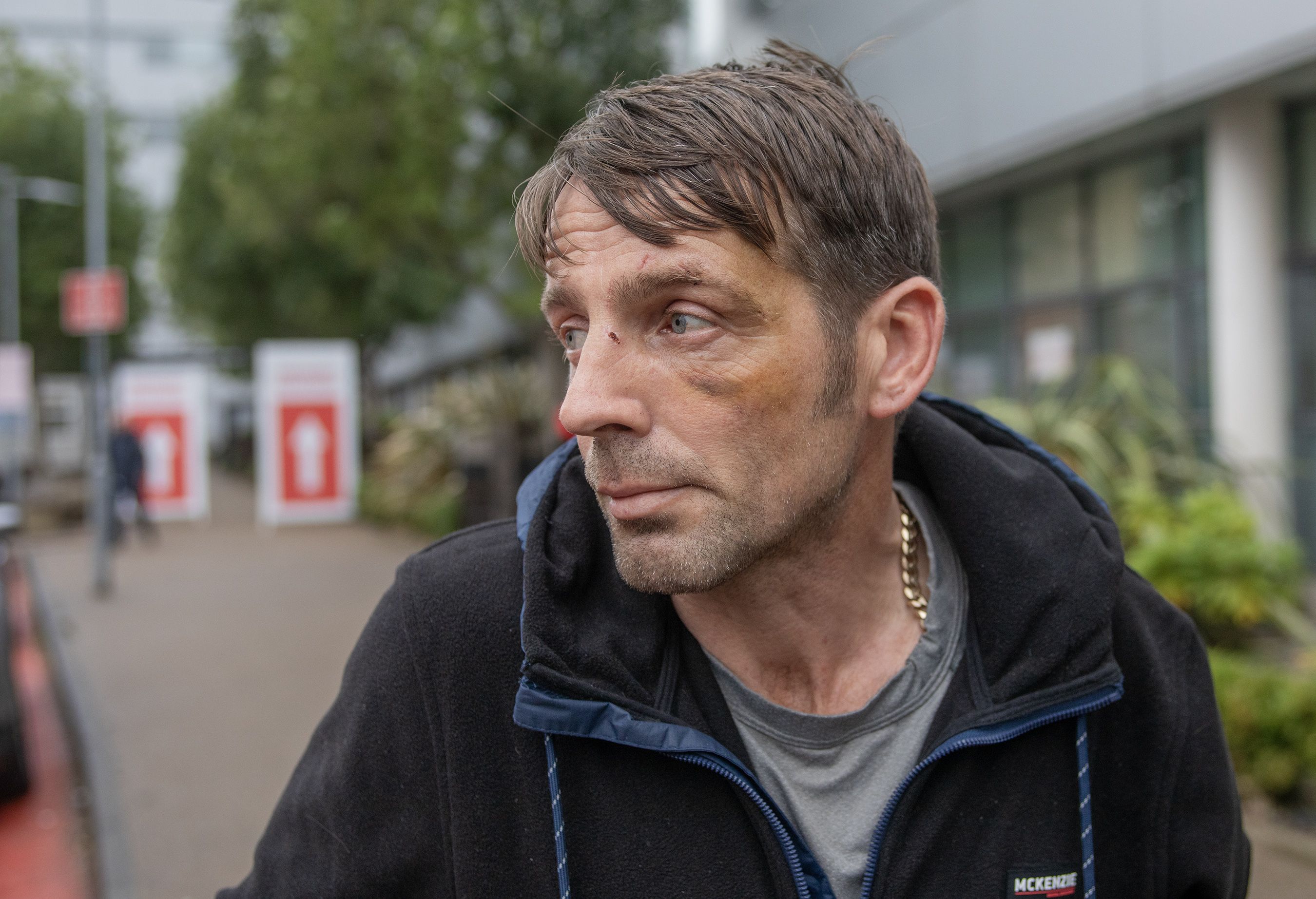 Man battered on Suffolk Road: 'I want to let people know I'm totally ...
